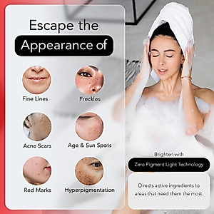 Kojie San Skin Brightening Soap - Bundle Pack - Original Kojic Acid, Dark Spot Remover Bar Soap with Coconut & Tea Tree Oil - 65g x 4 Bars