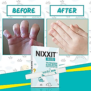 NIXXIT Nail Biting Treatment for Kids - Stop Thumb Sucking for Kids, Toddlers, Children - No Bite Nail Polish Pen - Non Glossy - Bitter Taste - Safe & Effective Solution