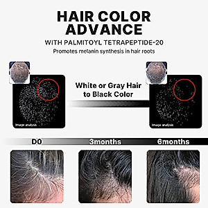DERMACENTRIC Black Hair Repair Tonic Spray | Vegan Gray Hair Spray for Hair Growth & Scalp Care | Korean Hair Care for Men & Women Unscented Root Touch Up Hair Regrowth Tonic Spray (3.38fl oz)