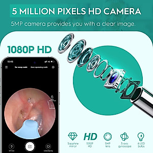 Earwax Camera Ear Camera Otoscope Cleaner, Oxbird 1080P Wireless Ear Wax Removal Kit Smart Ear Cleaner with Camera and Light for iPhone, Ipad & Android Smart Phones (Black)