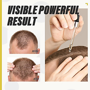 Biotin Hair Growth Serum for Stronger & Thicker Hair, Natural Ingredients for All Hair Types, Men and Women