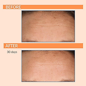 Serious Skincare - Serious C3 Vitamin C Plasma Night Trio Set - C-Restore Night Cream, C Eye Beauty Treatment and C Clean Facial Cleanser - Fine Lines, Mature Dry Skin - Smoother Radiant Skin