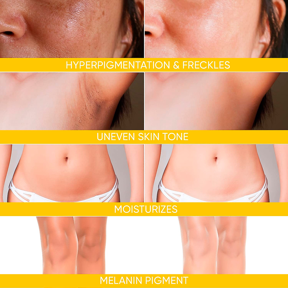 Ashania Dark Spot Remover For Body Cream, Dark Armpit Remover, Neck, Elbows, Armpit, Knees, Bikini Areas, Inner Thighs, Sun Spot and Private Areas