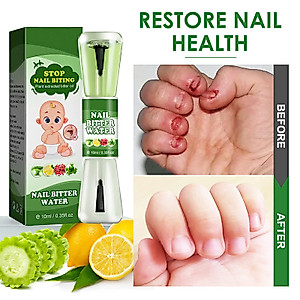 SANQIZ Nail Treatment - Bitter Taste, Safe Natural Plant Extract - 0.35 Fl Oz Drop - Nail-Biting and Thumb-Sucking Deterrent