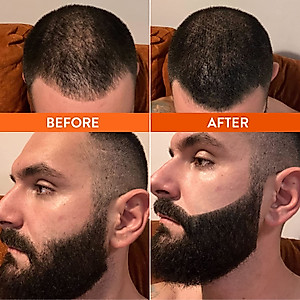 Beard Styling Pencil Kit - Medium Brown Beard Pen 4 Tip Micro-Fork and Beard Pen Filler