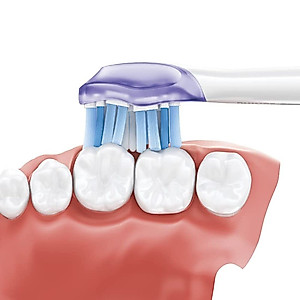 Philips Sonicare HX9924/01 Electric Rechargeable Sonic Toothbrush with Smart Sensor Technology, 5 Flexible Brushing Modes, 3 Intensities and USB Charging Travel Caser