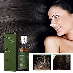 Hair Growth Spray – For Longer, Thicker, Fuller Hair - with Biotin & Caffeine - Hair Growth Products – Paraben Free Growth Serum – All Hair Types – Reverse Hair Loss - for Women & Men