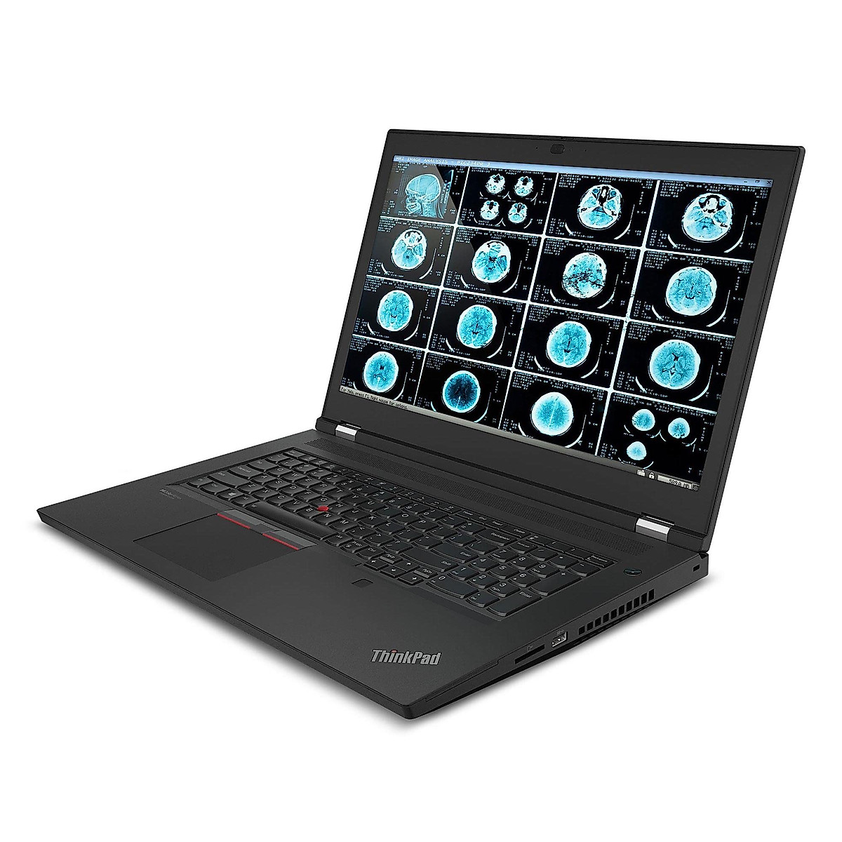 Lenovo ThinkPad P17 Gen 2 Workstation Laptop (Intel i9-11950H vPro 8-Core, 16GB RAM, 1TB PCIe SSD, RTX A2000, 17.3" 60Hz Full HD (1920x1080), Fingerprint, WiFi, Win 11 Pro) with Dockztorm Hub