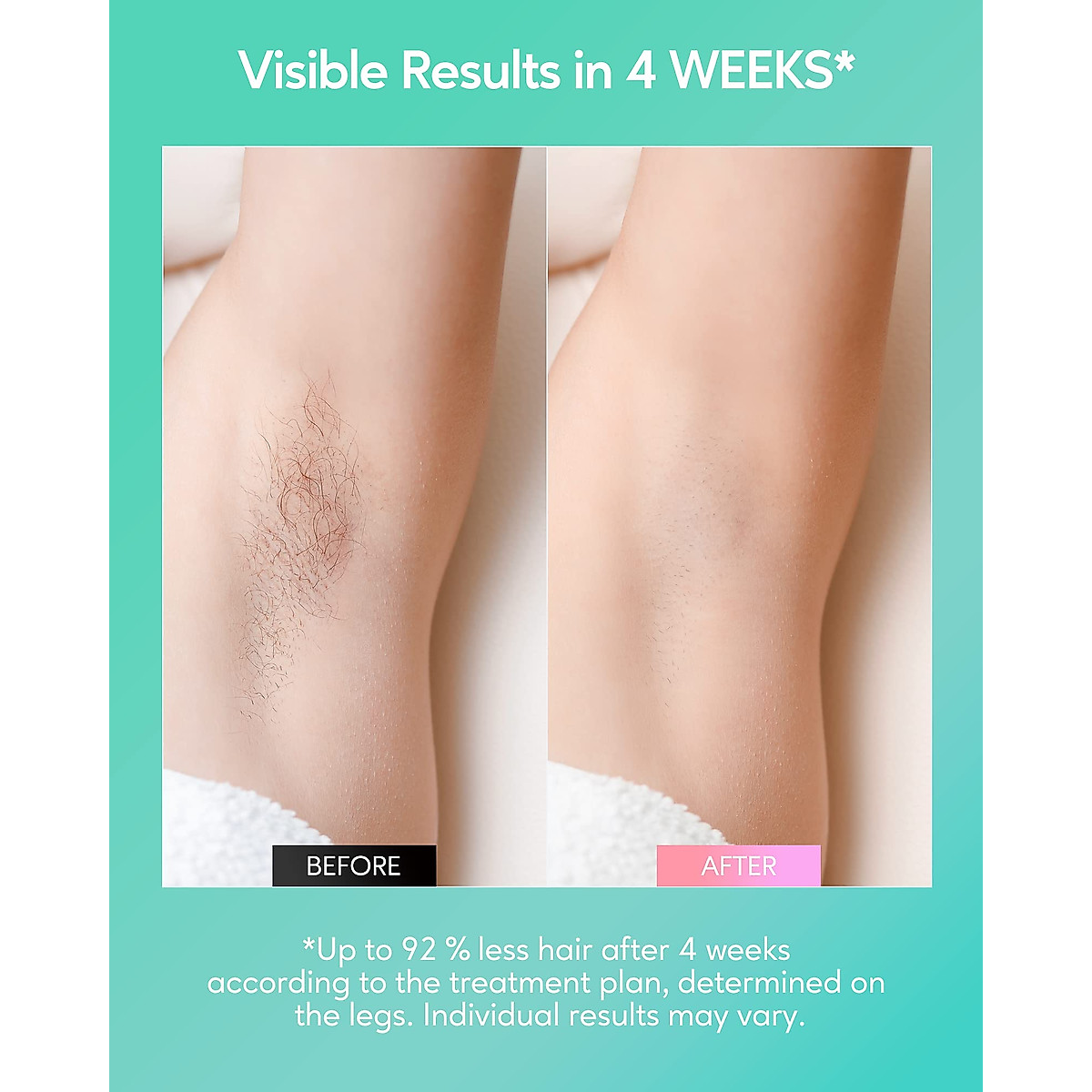 INNZA IPL Hair Removal Device for Women and Men at Home,Permanent Hair Remover Machine,10 Energy Levels,24J High Energy Hair Removal Handset for Face Bikini Line Armpit Leg Back,Corded