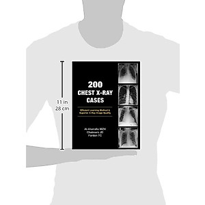 200 Chest X-Ray Cases