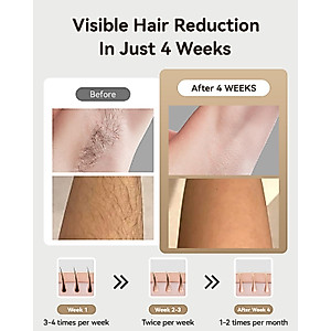 MEGELIN X PRO IPL Hair Removal for Women and Men, 21J Sapphire Cooling System Permanent Lase Hair Removal Device with Unlimited Flashes, Painless at-Home Remover for Facial Bikini Lines Legs Arms