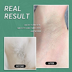 Maxpearl Wax Beads for Hair Removal, 2.5lb Hard Wax Beans Refill Bag for Brazilian Bikini, Face, Eyebrows, Underarms, Arms, Chest, Back, Legs, Coarse Body Hair Specific