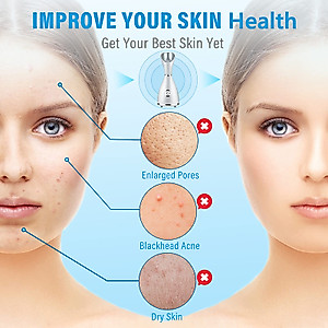 Face Steamer for Facial Deep Cleaning Nano Ionic Face Steamer Warm Mist Humidifier Face Steamer Home Sauna SPA Face with 4 Piece Stainless Steel Skin Kit,Hair Band,Wash Face Sponge