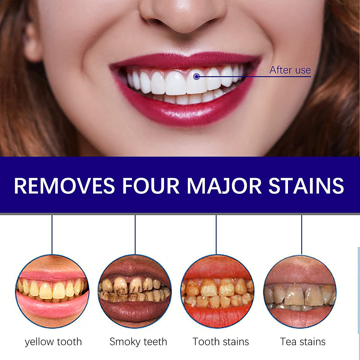 Teeth Whitening Pen 4 Pens for 70+ Uses, Twice a Day for Visibly Whiter in 1 Week, Effective Painless No Sensitivity Vanilla Mint Flavor