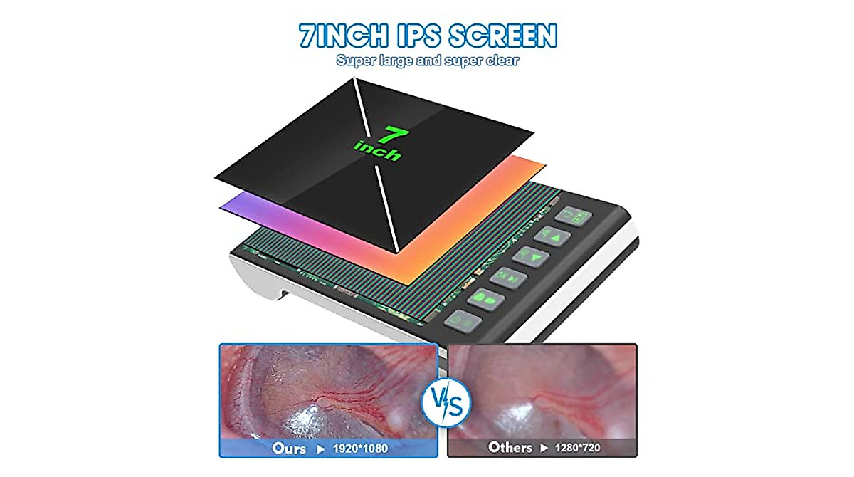 Digital Otoscope with 7-Inch Screen & 3.9mm Ear Camera | Hiacinto
