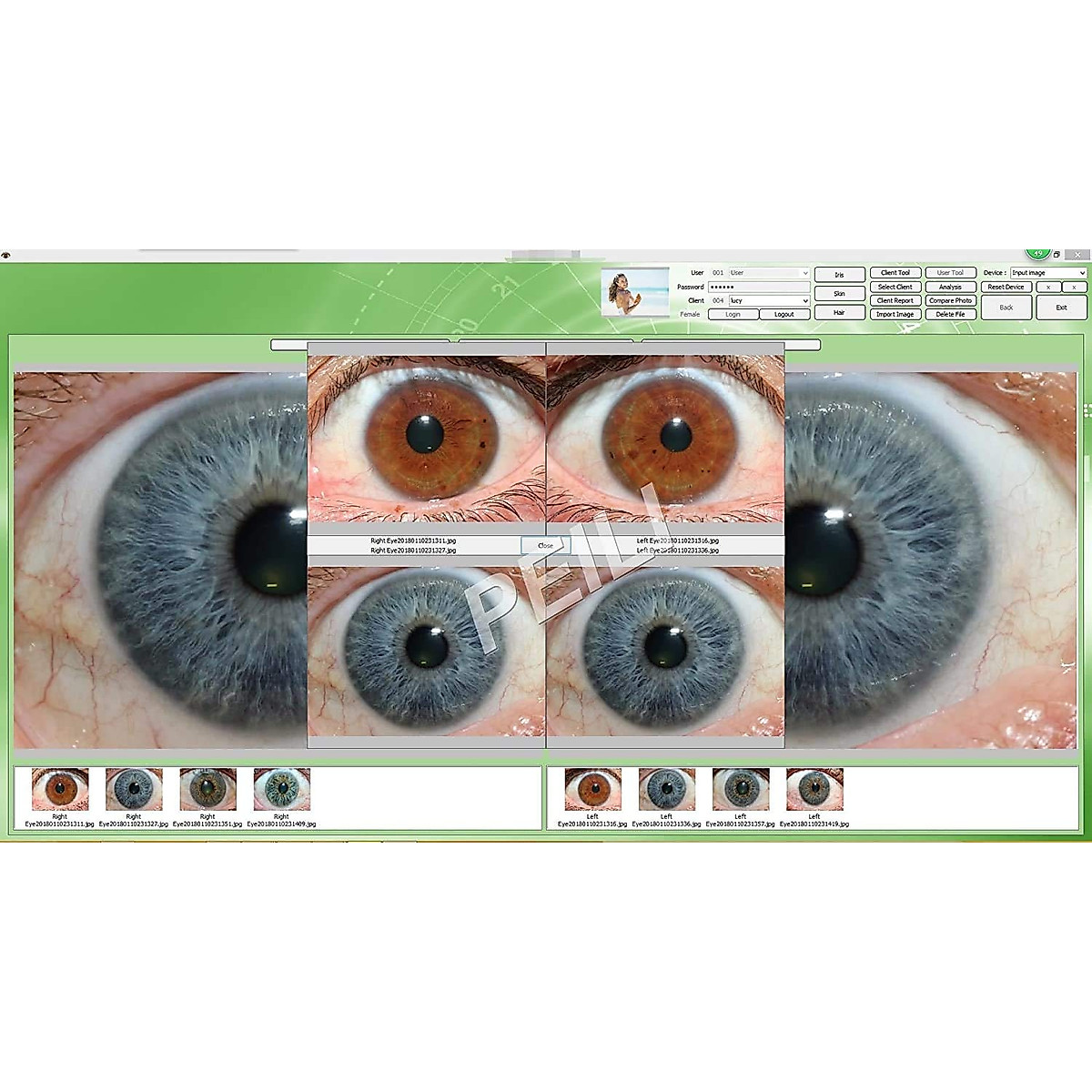 Iriscope Iridology Camera 5.0 MP LED Light Iris Analyser Iridoscope iriscopio