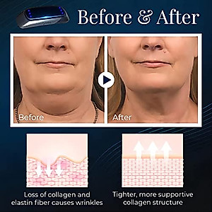 Nubeauty Sleeping V-Face Beauty Device,Sleeping V Face Beauty Device,Nu Beauty Ems Sleeping V Shape,Nubeauty+ Sleeping V-Face Beauty Device (2P)