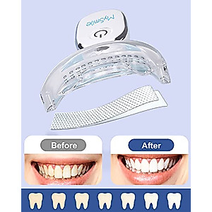 MySmile Teeth Whitening Kit with led Light, 28X Teeth Whitening Strips for Teeth Sensitive, 10 Min Fast Whitening Teeth, Helps to Remove Stains from Coffee, Smoking, Wines(1Pcs Light + 14Sets Strips)