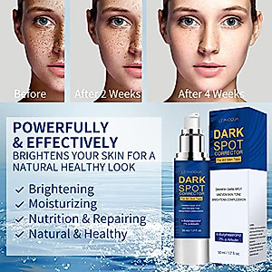 Advanced Dark Spot Remover For Face & Body, Dark Spot Corrector Cream For Face, Fade Cream For Dark Spots & Sun Spot Remover, Blemish Spot, Melasma & Hyperpigmentation Treatment With Nicotinamide & 4-Butylresorcinol