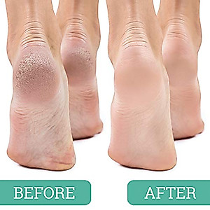 Maccibelle Salon Foot Pumice and Scrubber for Feet and Heels Callus and Dead Skins, Safely and Easily Eliminate Callus and Rough Heels (Pack of 4)