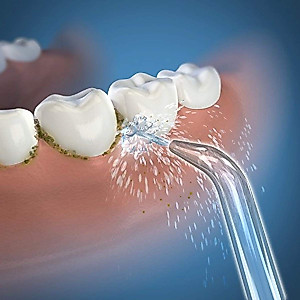 Flosser Replacement Tips for Waterpik Water Flosser, High-Pressure Jet Tips, Flosser Refill Replacement Heads, Compatible with Waterpik Oral Irrigator and Dental Flossers, Orthodontic Tips 4 Packs