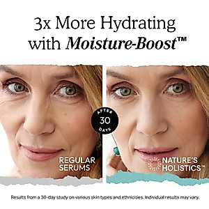 Nature's Holistics Anti-Aging Retinol Serum, 1 oz