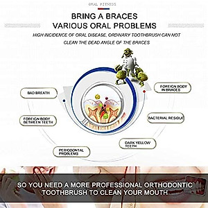 Chargenyang 3 Pack Denture Cleaning Brush Set Hard Denture Toothbrush Portable Denture Toothbrush Cleaning Brush Double Sided Denture Brush for Denture Care