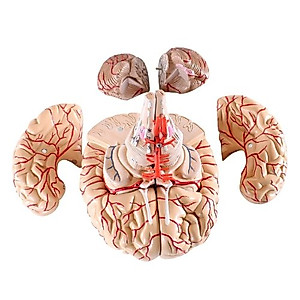 Wellden Medical Anatomical Brain Model, with Arteries, 9 Parts, Life Size