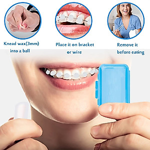 Braces Wax for Teeth 6 Pack Dental Care Orthodontic Wax for Braces Wearer (6 Pack, Colorful)