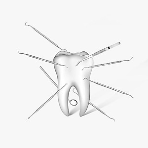 GSHLLO 4 Pcs Stainless Steel Tartar Remover Dog Teeth Picks Dental Tartar Removal Cleaner Tooth Plaque Scraper Pet Oral Cleaning Tool