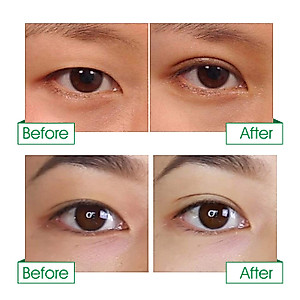 2Bags/656Pcs Invisible Slim Double Eyelid Tapes Lift Strips Stickers, One-sided Sticky, Instant Eyelids Lift, Suitable for Saggy, Hooded, Droopy, Uneven, Mono-eyelids