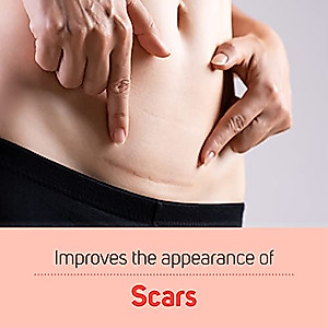 Care Science Stretch Marks + Scars Skin Care Body Oil, 5 OZ | For C Section Recovery, Scars, Stretch Marks, Hair, Aging, Dehydrated Skin | Natural Ingredients, Vitamin E Oil, Olive Oil, Coconut Oil