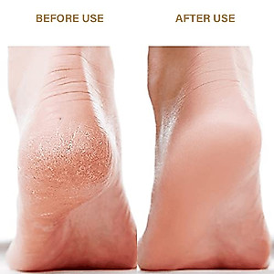 Foot Masks Puresoak Bath Foot Peel Mask (2 Pairs) + Moisturizing Foot Mask (2 Pairs) with 1Pack Epsom Salt Foot Spa Bath Kit Gift Set | Lavender Bliss Foot Peel Mask Lemongrass & Aloe Moisturizing Mask Foot Relaxing Soft Treatment for Women & Men Foot Car