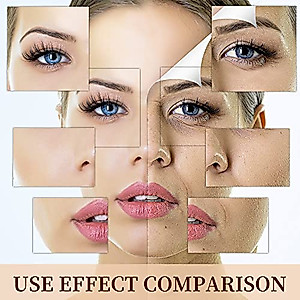 GRITRIVAL Pdo Threads, For Face Thread Lift, Korean Protein Thread Lifting (20Pcs-30G*25MM)