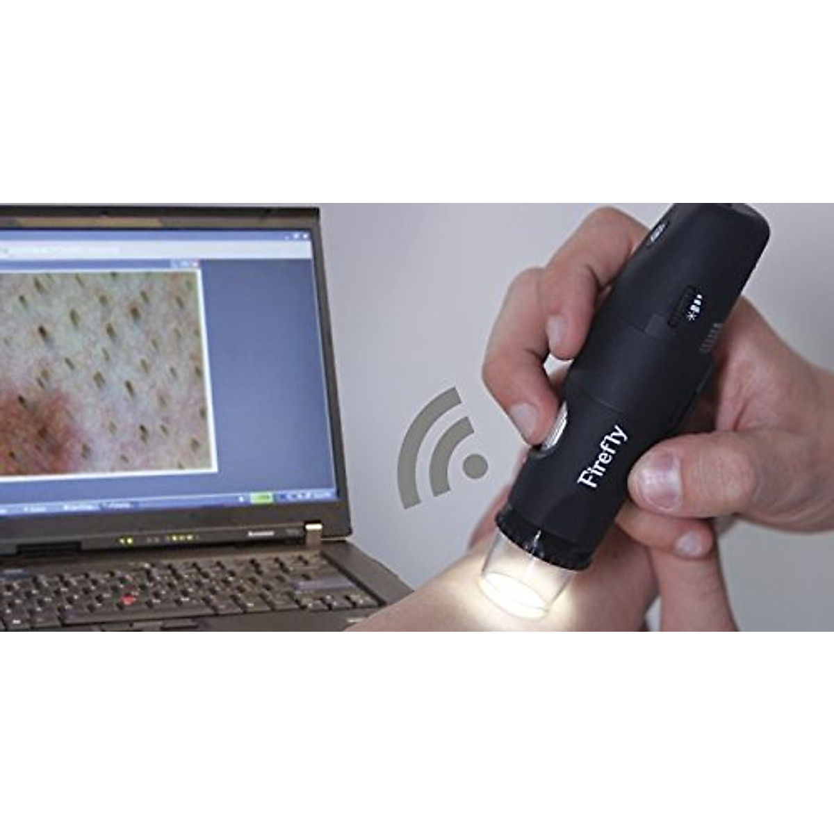 Firefly DE350 Wireless Polarizing Dermatoscope