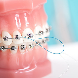 Floss Threaders, Deep Clean Dental Floss Threader for Braces, Bridges, and Implants 200PCS(4Pack),Blue