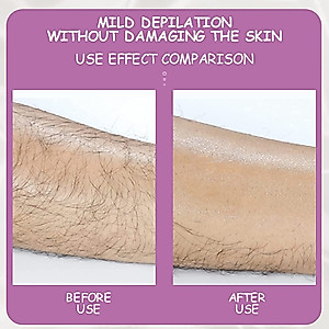 Crystal Hair Eraser for Women and Men, Magic Remover Painless Exfoliation Removal Tool, Arms Legs Back (black)