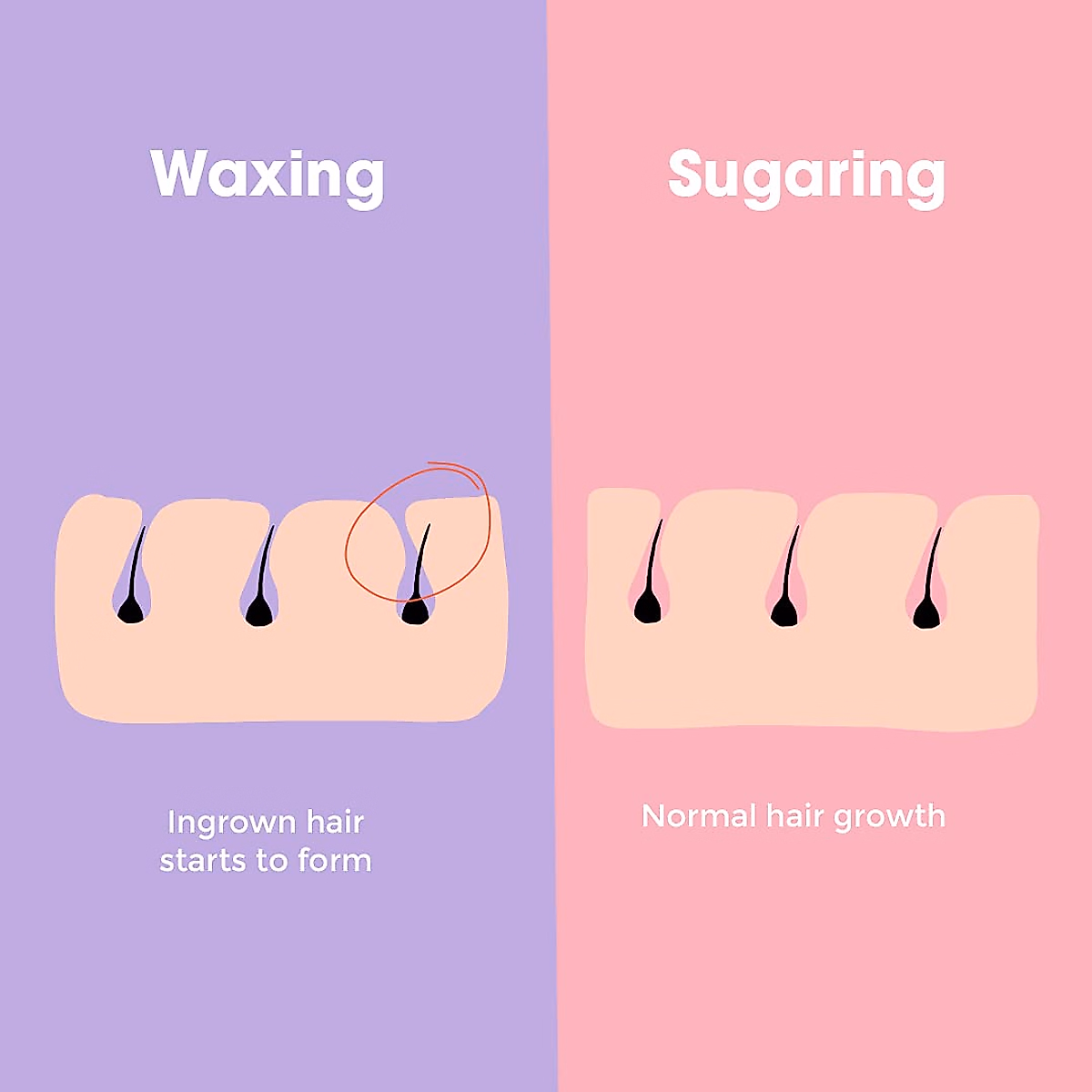 Sugaring NYC Brazilian Bikini Sugaring Paste - Medium, 45 Fl Oz, For Various Hair Types, Unisex, Hair Removal Paste