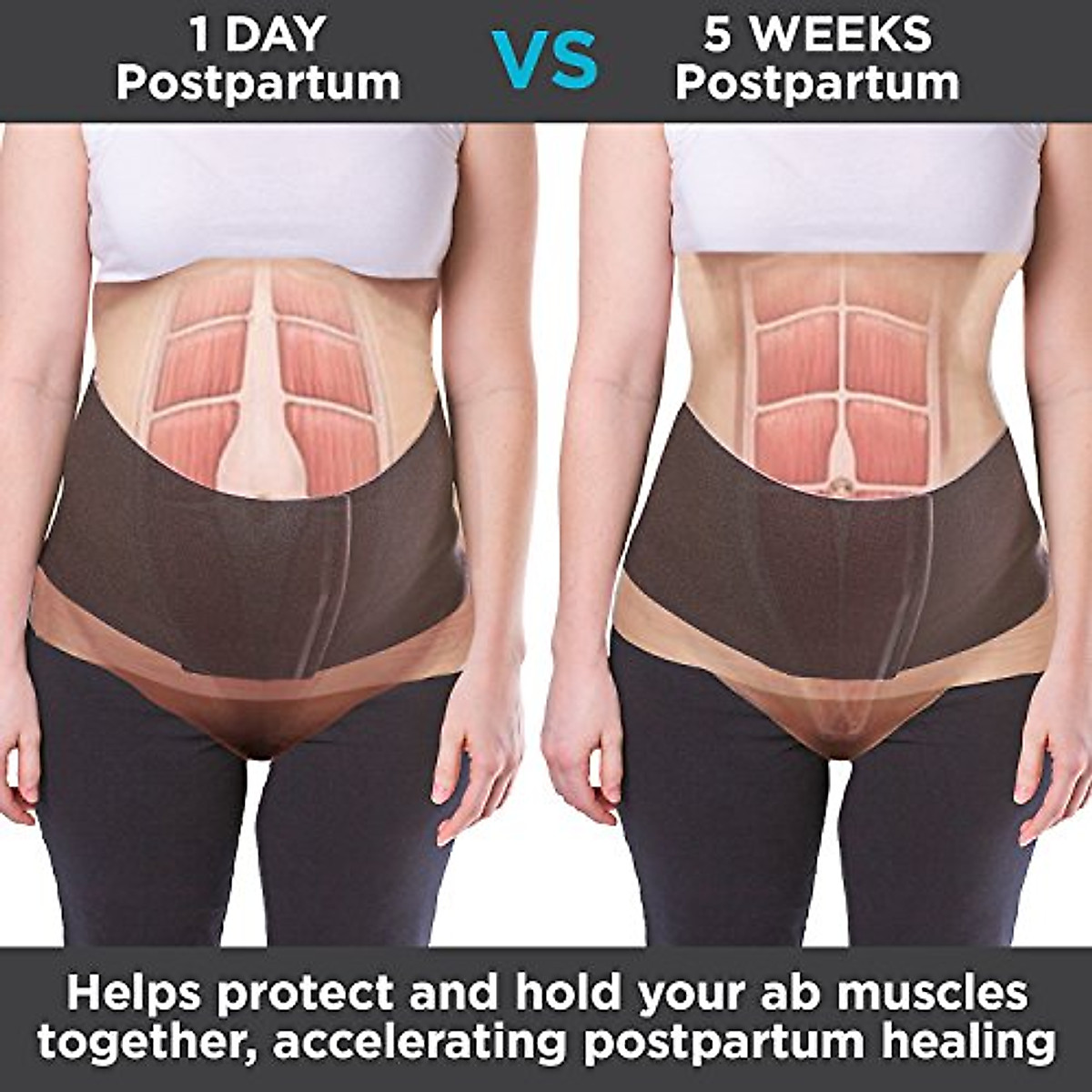 BraceAbility Abdominal Treatment Wrap for Diastasis Recti | Breathable, Non-Slip Postpartum Tummy Slimming Band for Stomach Muscle Support, Back & Waist Compression After Pregnancy (XS)