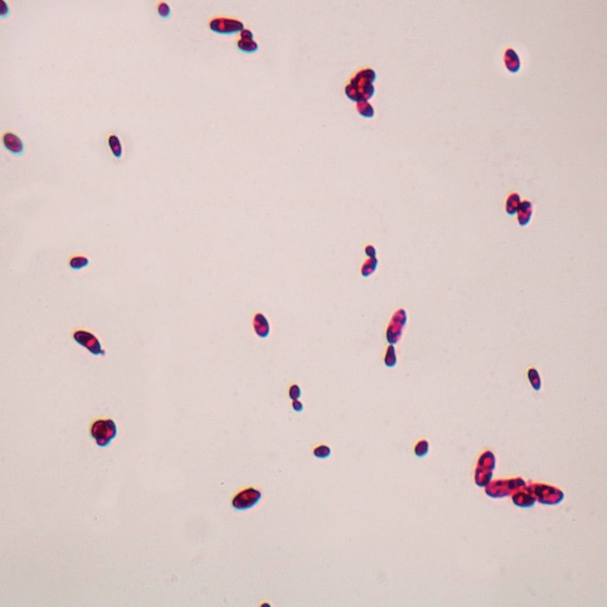 Candida Albicans, W.M. Microscope Slide