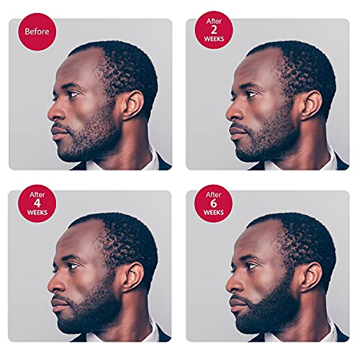 Godefroy Thick Beard and Mustache Growth Serum For Ethnic Hair Types, 15 ml