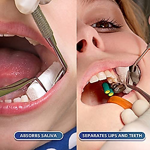 400 PCS Dental Gauze Rolls Cottons Pads, Nosebleed Kit Accessories #2 Medium 1.5" Mouth Gauze Nose Plugs for Dental Clinic, Household