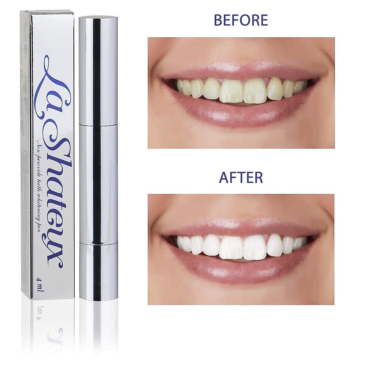 Premium Teeth Whitening Non Peroxide Formula Pen - 40+ Uses - No Sensitivity - Healthy Teeth Whitening - Snow White Teeth