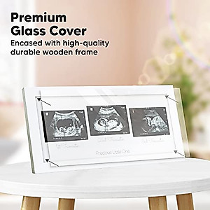 Sonogram Picture Frame - Trio Ultrasound Picture Frames For Mom To Be Gift - Baby Ultrasound frame - Pregnancy Announcements Sonogram frame - Baby Nursery Decor, Pregnant Mom Gifts (Alpine White)
