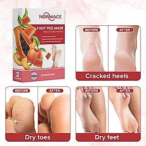 Normace Exfoliating Foot Mask( 2 Pairs) With All Passing Microbial Tests In USA LAB for Dry, Cracked Feet, Callus, Dead Skin Remover For Soft Baby Feet