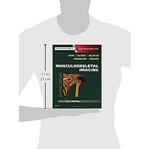 Musculoskeletal Imaging: Expert Radiology Series