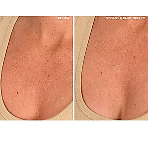 SiO Beauty ChestLift - Chest Anti-Wrinkle Pad 4 Weeks Supply - Overnight Smoothing Silicone Pad For Cleavage & Decollete Skin