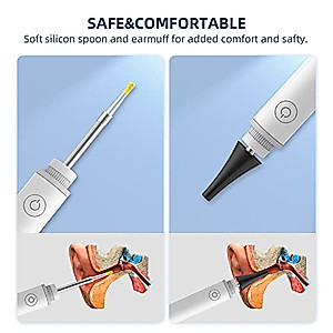 Ear Scope, Ear Wax Removal Tool Camera Wireless Otoscope 1080P Ear Cleaner Camera, Otoscope with Light Ear Wax Remover, Ear Endoscope Compatible with iPhone iPad Android