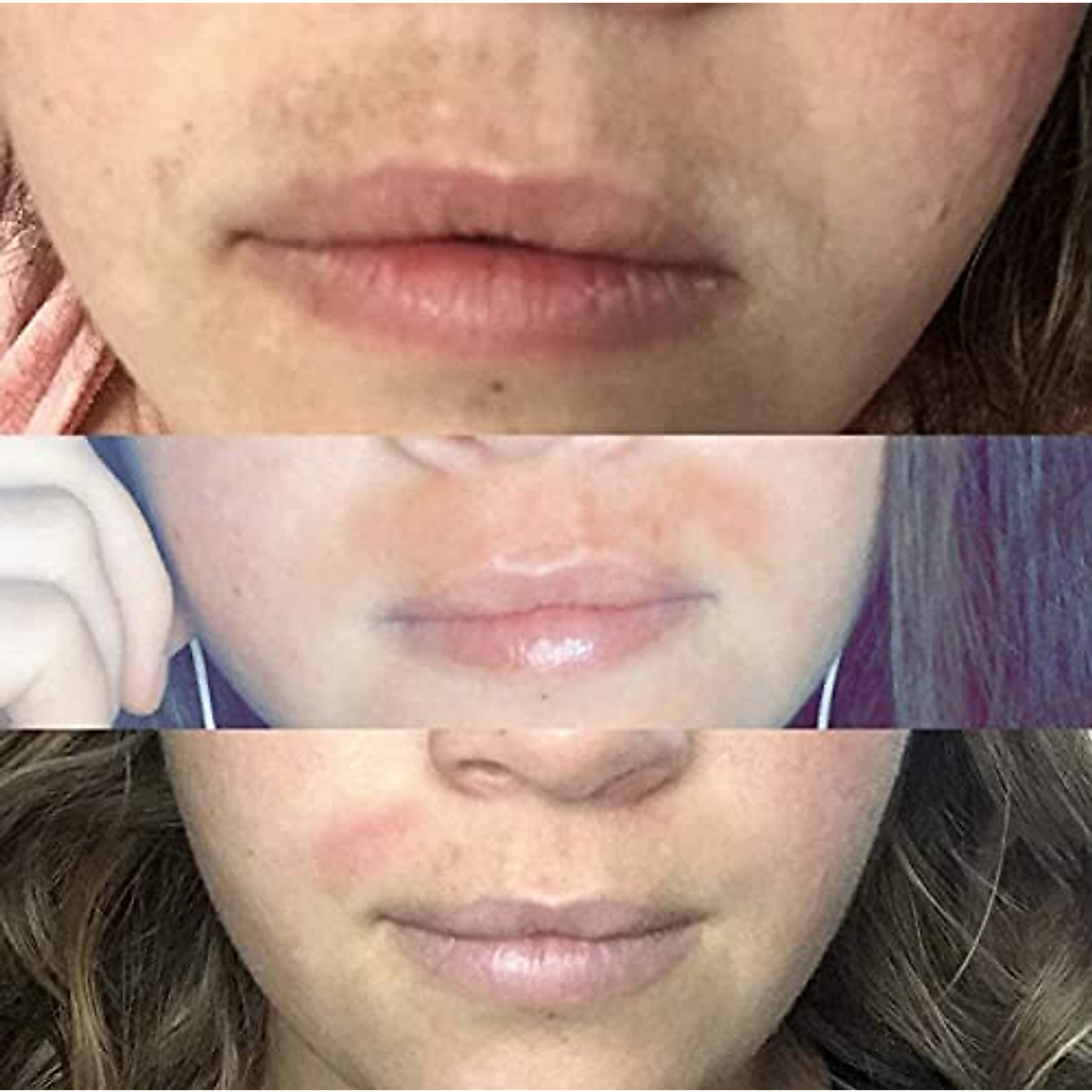 Dark Spot Corrector, Dark Spot Remover for Face, Melasma and Hyperpigmentation Treatment, Dark Spot Serum, Age Spot Remover, with Tyrostat, Kojic Acid, Alpha Arbutin, Mulberry Extract, Lactic Acid 1oz