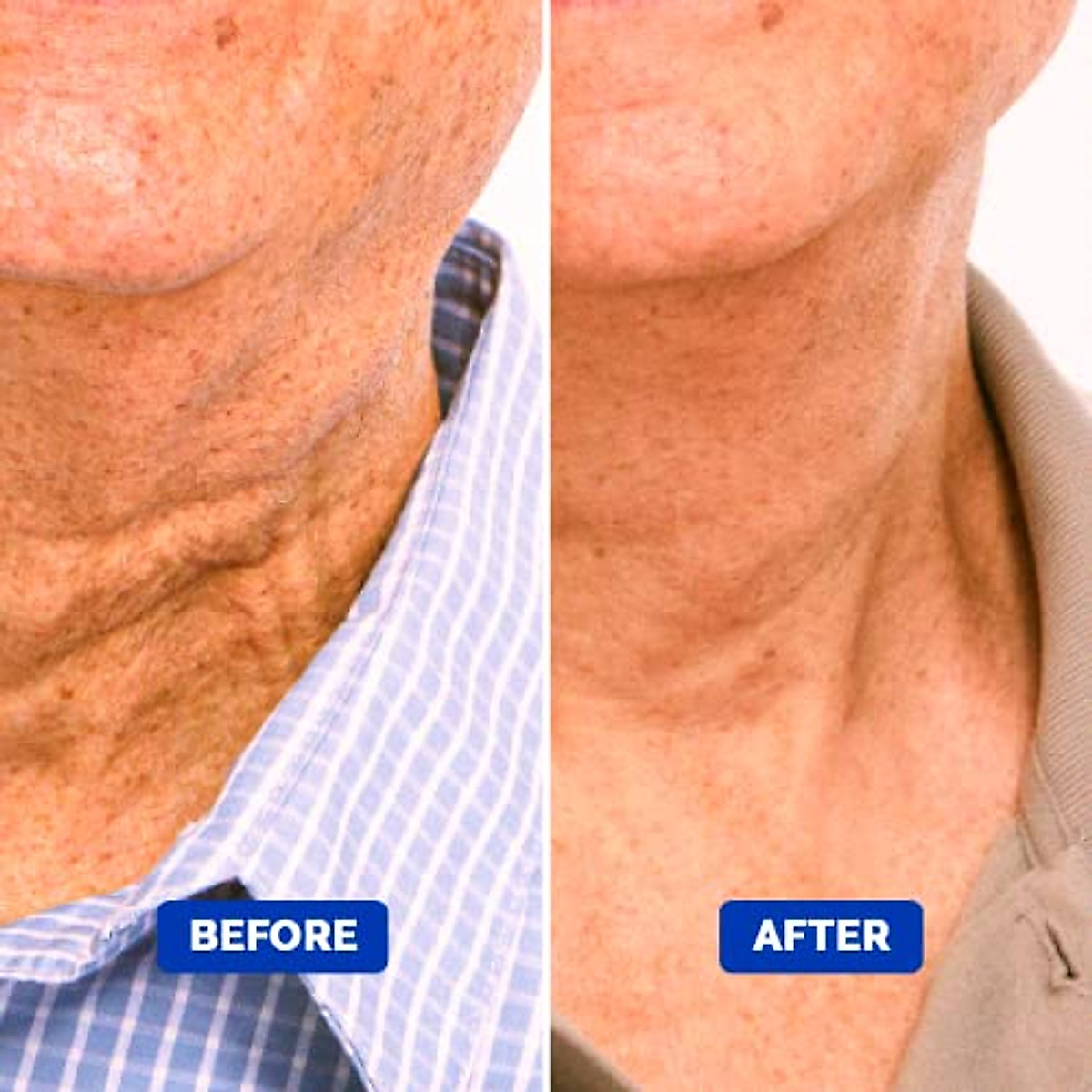 Particle Neck Cream for Men - Neck Firming Cream, Lift and Moisturize The Neck | Use on Saggy Skin or Turkey Neck | Anti Aging Triple Action Neck Cream with Collagen, Hyaluronic Acid, Retinol (50 ml)